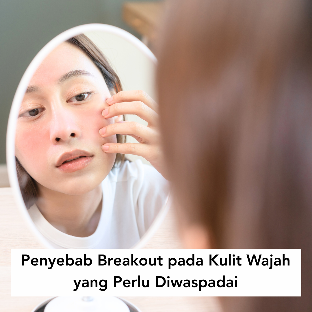 Penyebab Breakout pada Kulit Wajah yang Perlu Diwaspadai | Wardah Indonesia